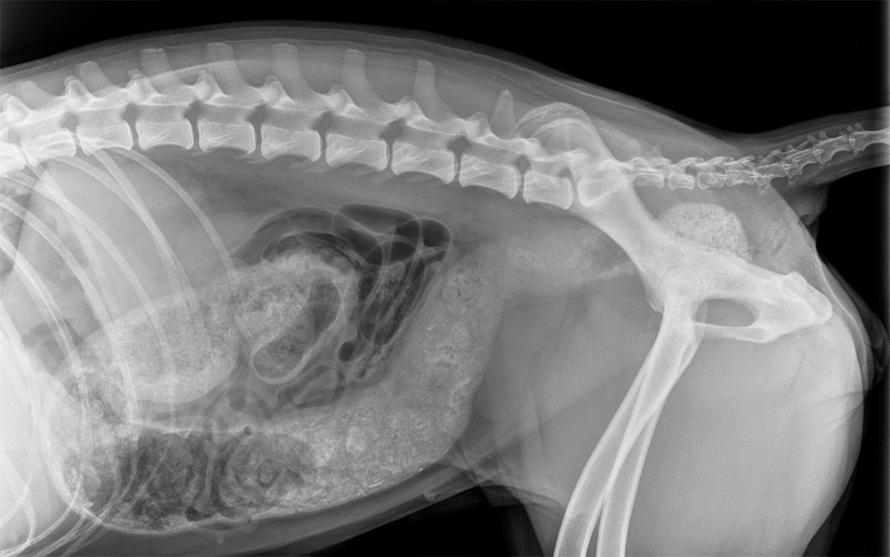Figure 4 — A large faecal impaction is present at the distal colon ...