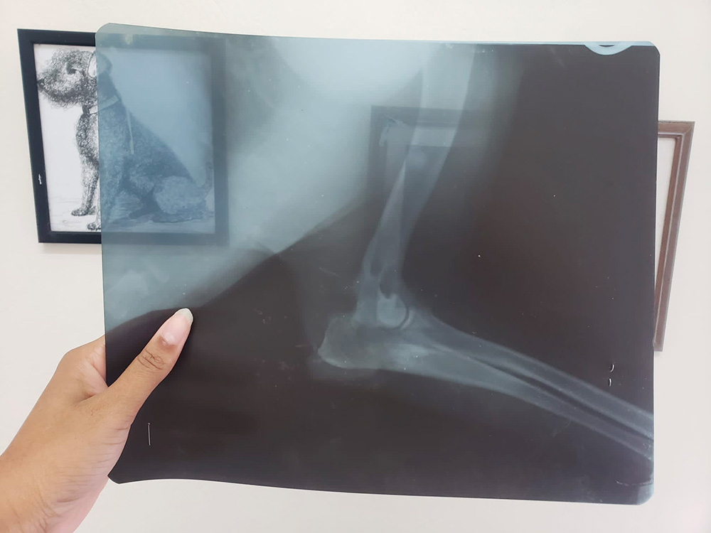 Figure 3 — A clinician holds up a film radiograph.