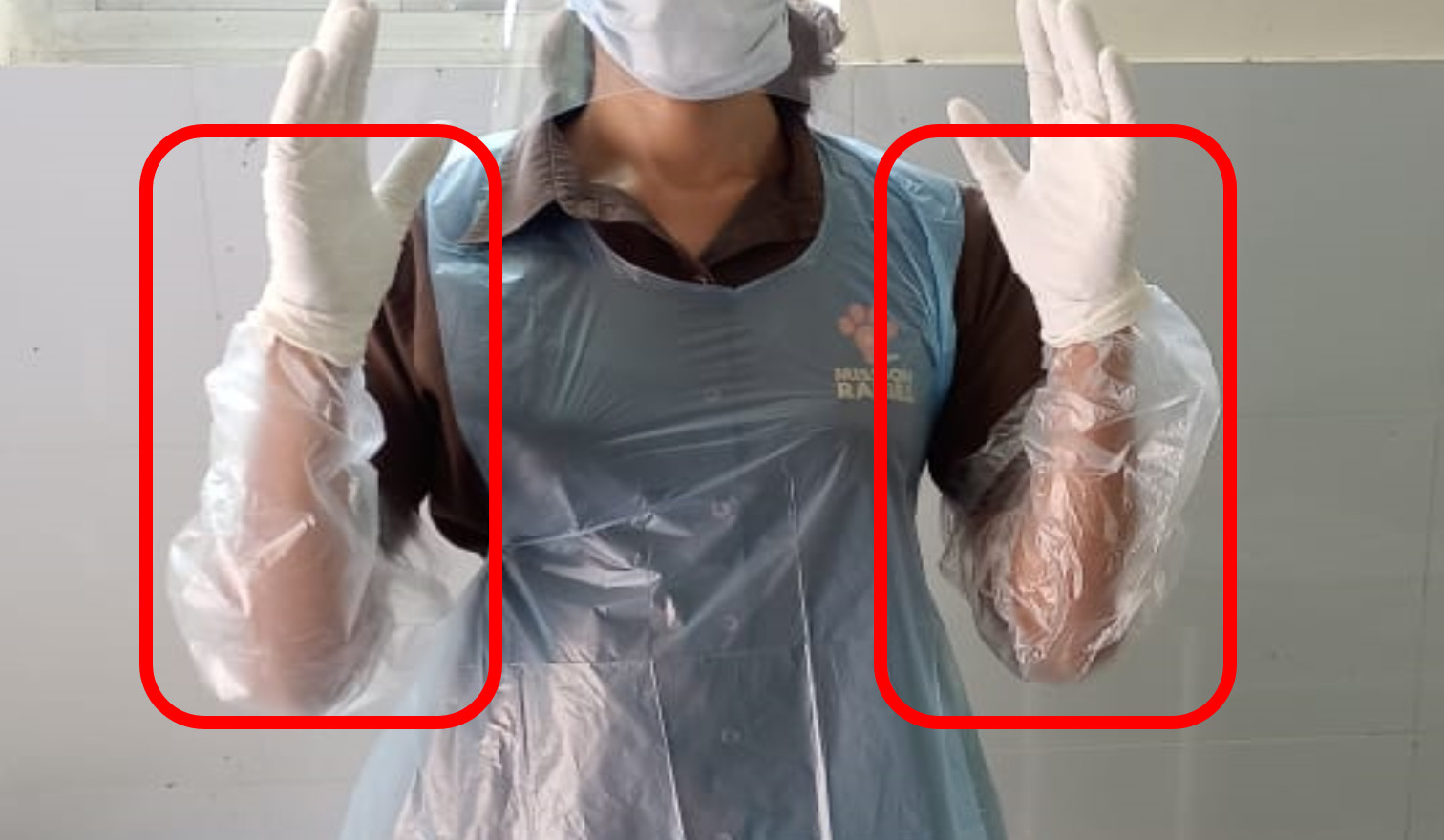 Figure 5 - Arm-length gloves