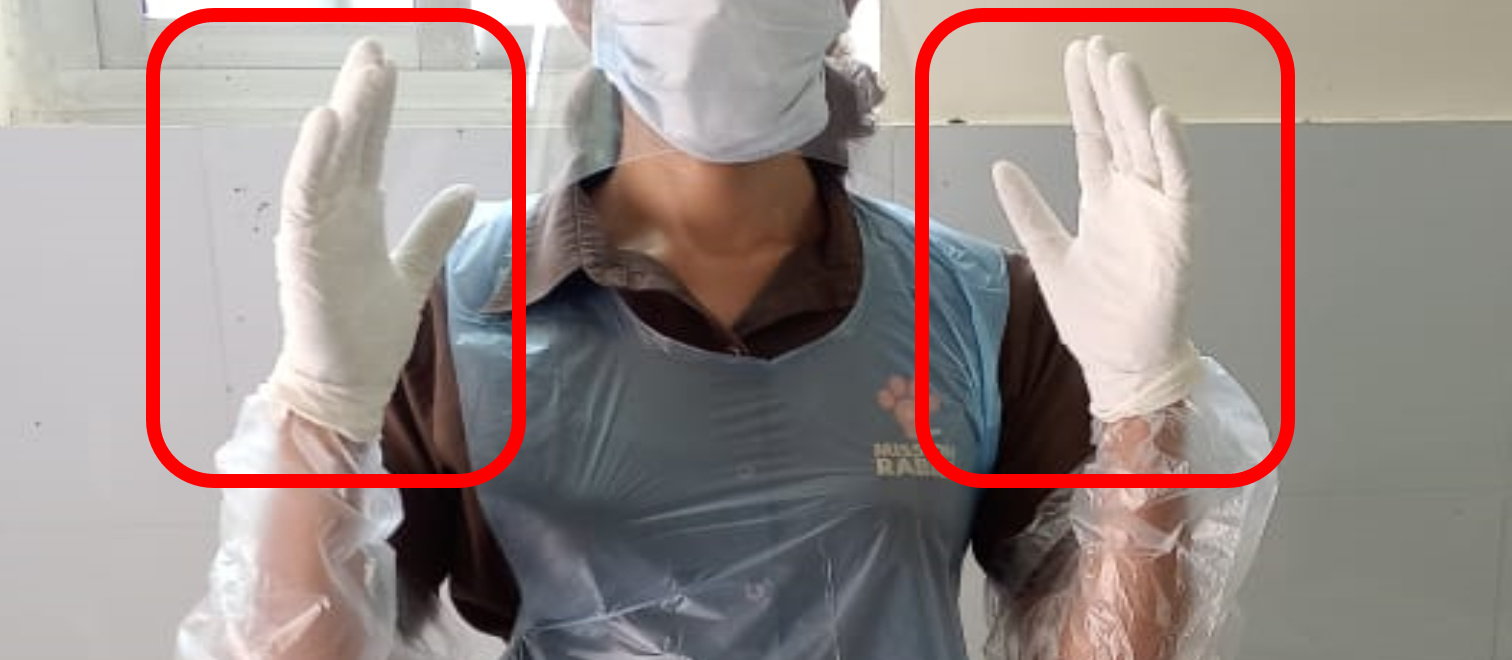Figure 6 - Hand gloves